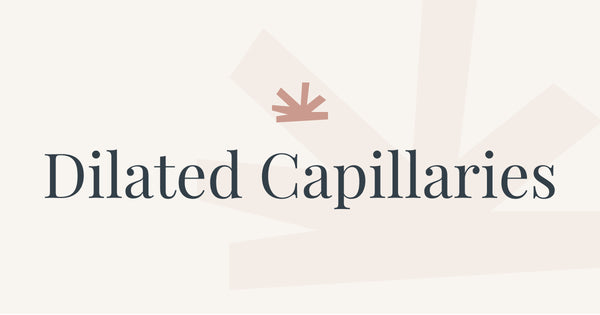 Dilated Capillaries | Products For Broken Capillaries